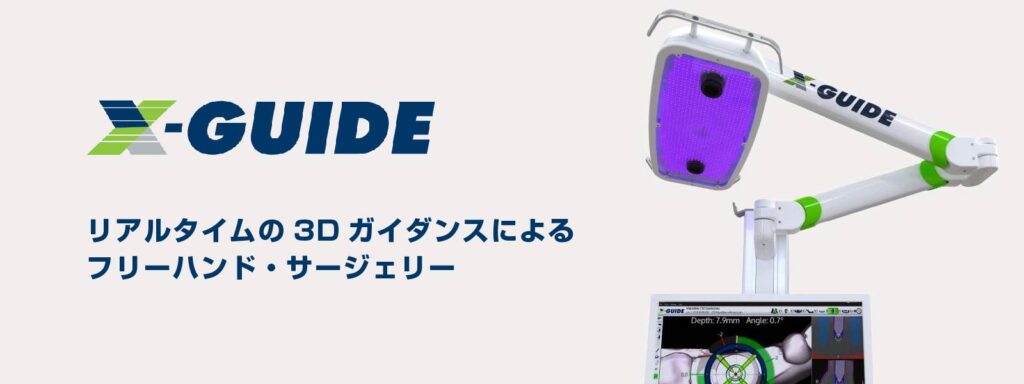 X-Guide（Xガイド） | 和光市で受けるインプラント｜『インプラント治療専門サイト』